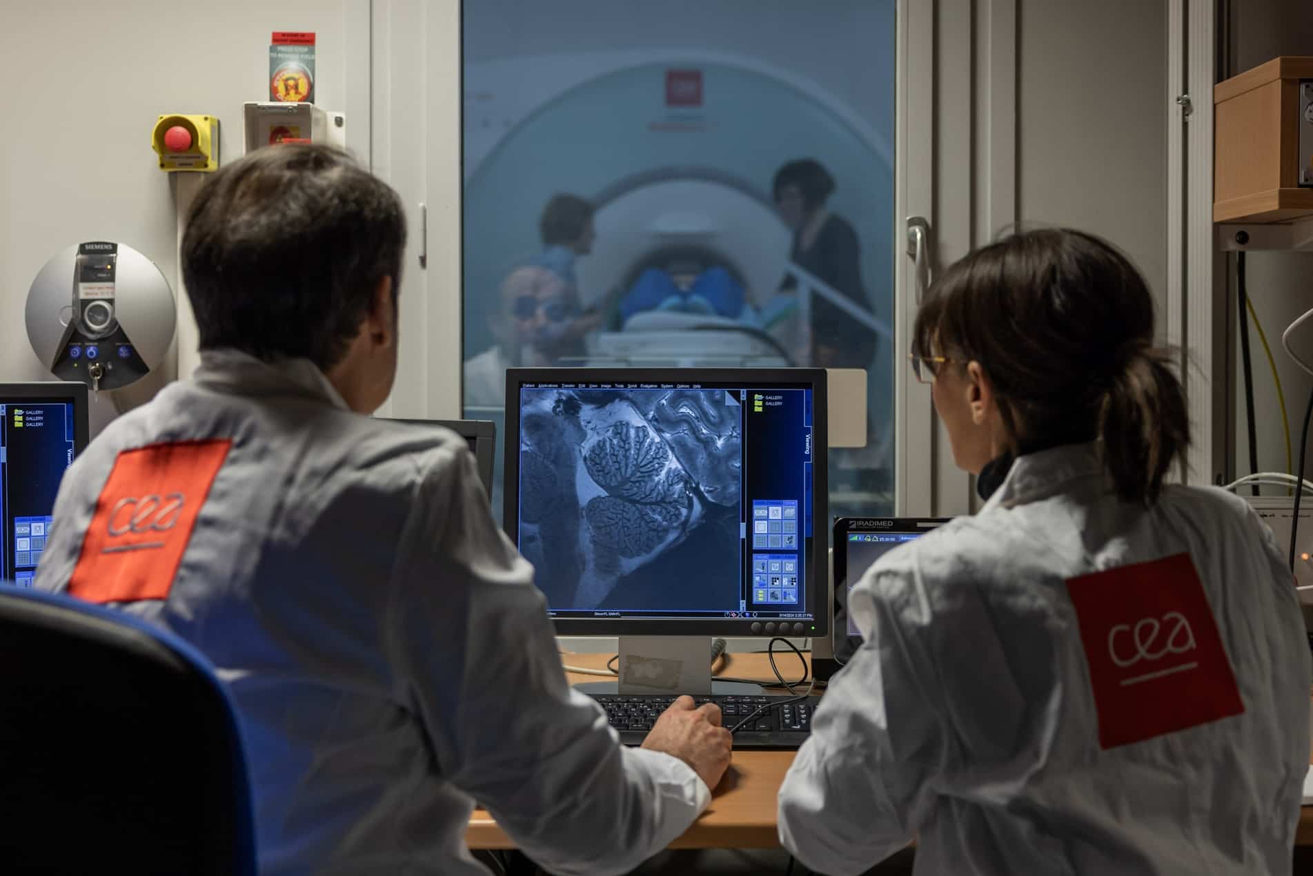 Iseult MRI: Revealing the Brain Like Never Before - French Healthcare